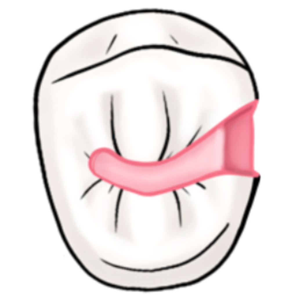 Resin Composite Operative Dentistry - My Dental Key