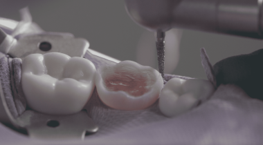 Stainless Steel Crown Preparation - My Dental Key