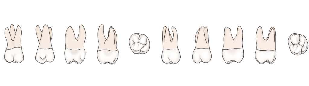 Maxillary Molars - My Dental Key