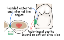 Class III Composite Preparation - My Dental Key