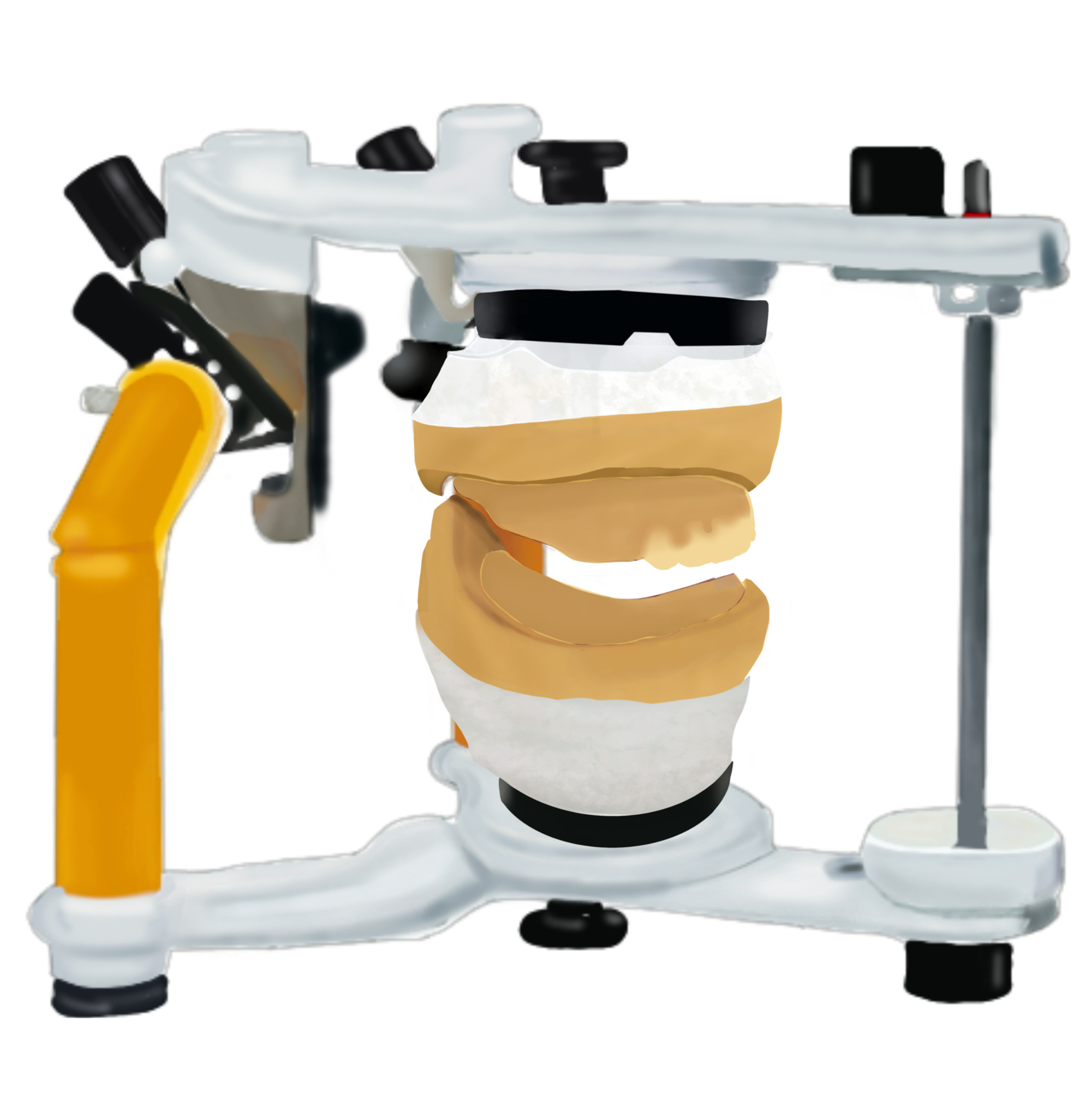 Removable Prosthodontics - My Dental Key