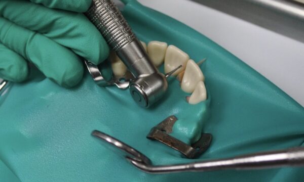 Class III Composite Preparation - My Dental Key