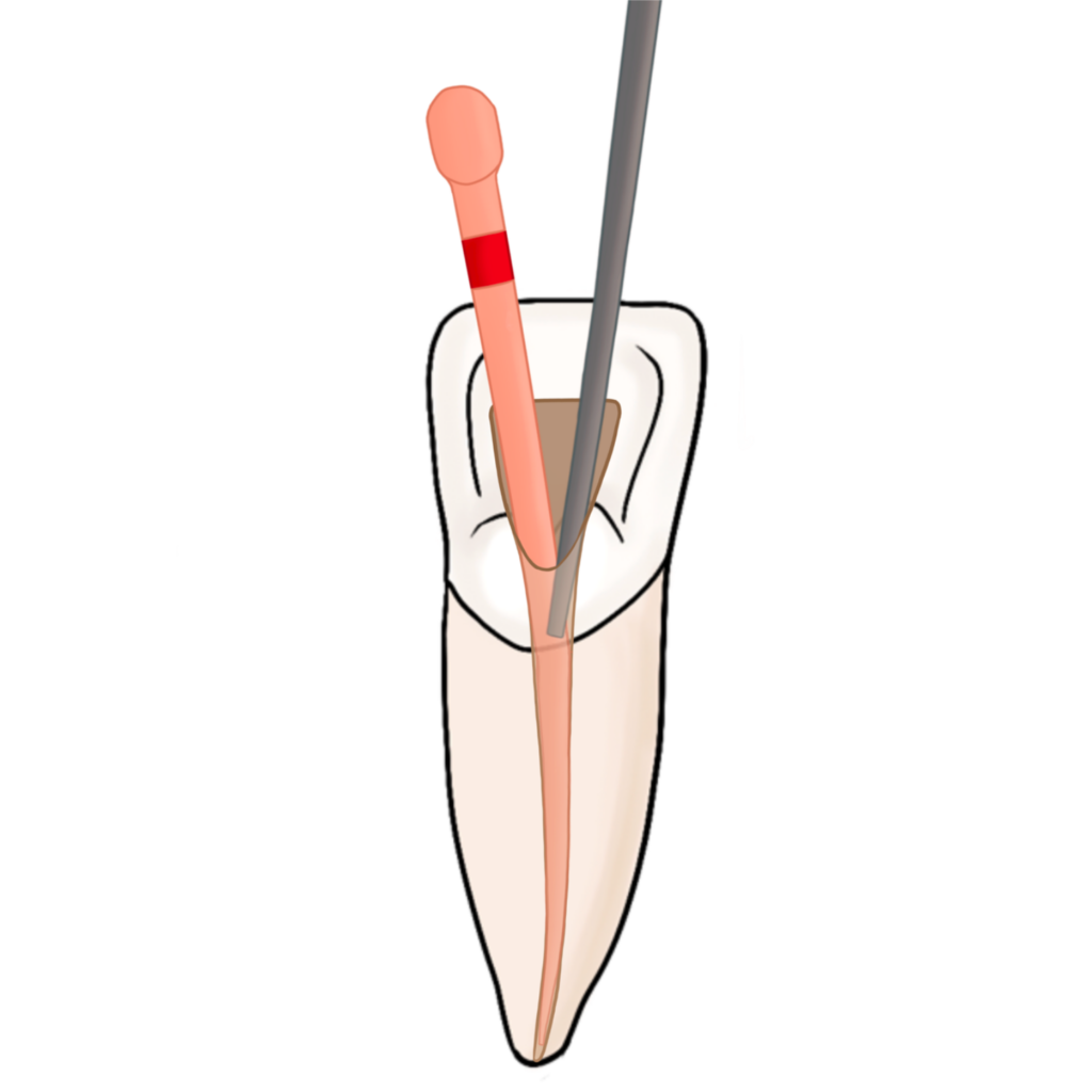 CDCA / ADEX - My Dental Key