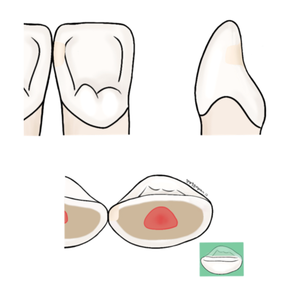 CDCA / ADEX - My Dental Key