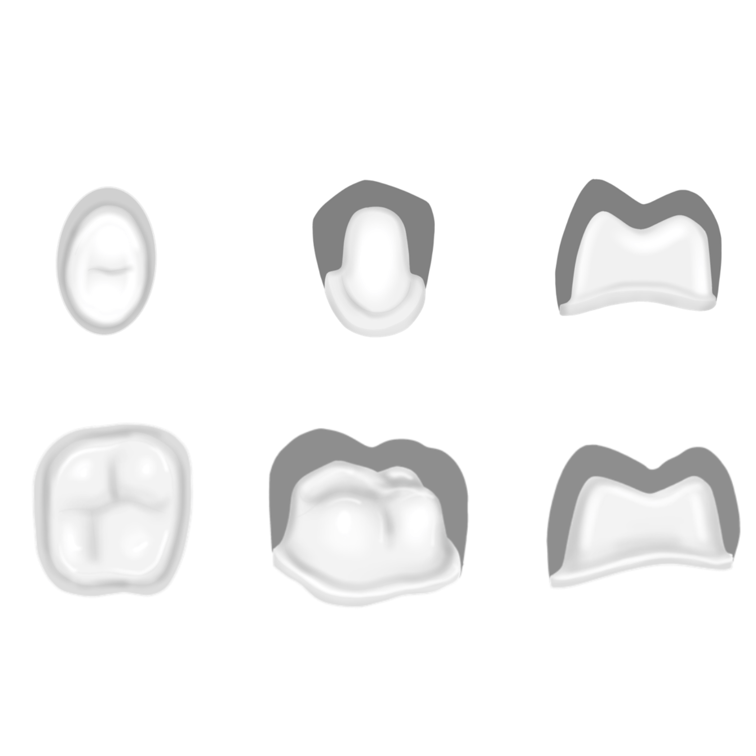 Fixed Prosthodontics - My Dental Key