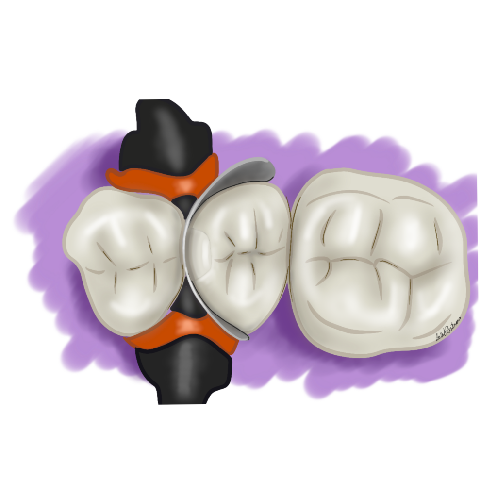 Basics - My Dental Key