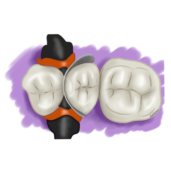 Basics - My Dental Key