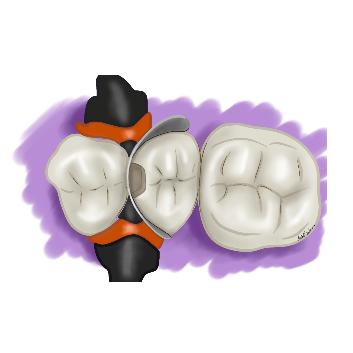 Basics - My Dental Key