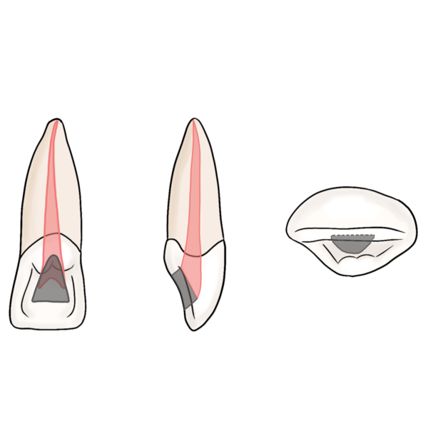 CDCA / ADEX - My Dental Key
