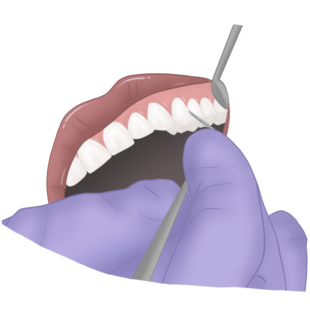 Endodontics - My Dental Key