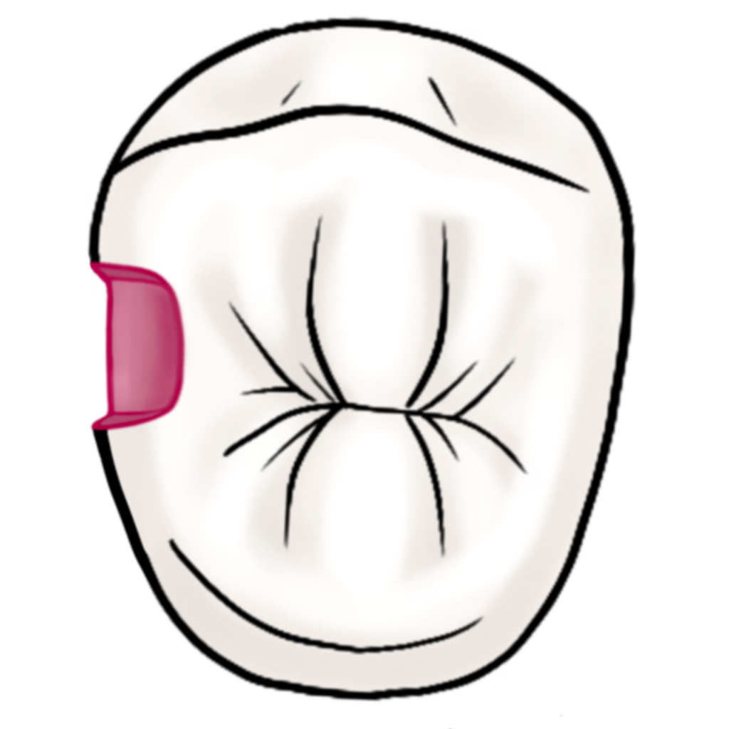 Resin Composite Operative Dentistry - My Dental Key