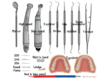 Class III Composite Preparation - My Dental Key