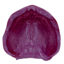 Maxillary Final Impressions - My Dental Key