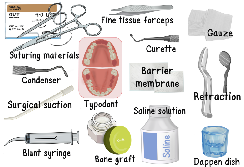 Socket Grafting Procedure - My Dental Key